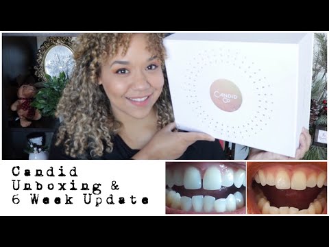 Candid Aligners Unboxing and Teeth Update