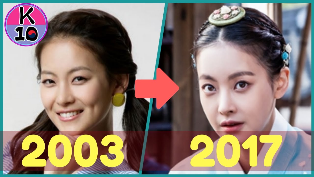 Oh Yeon Seo Plastic Surgery Hwayugi Oh Yeon Seo Evolution 2003 2017 답을 믿으세요