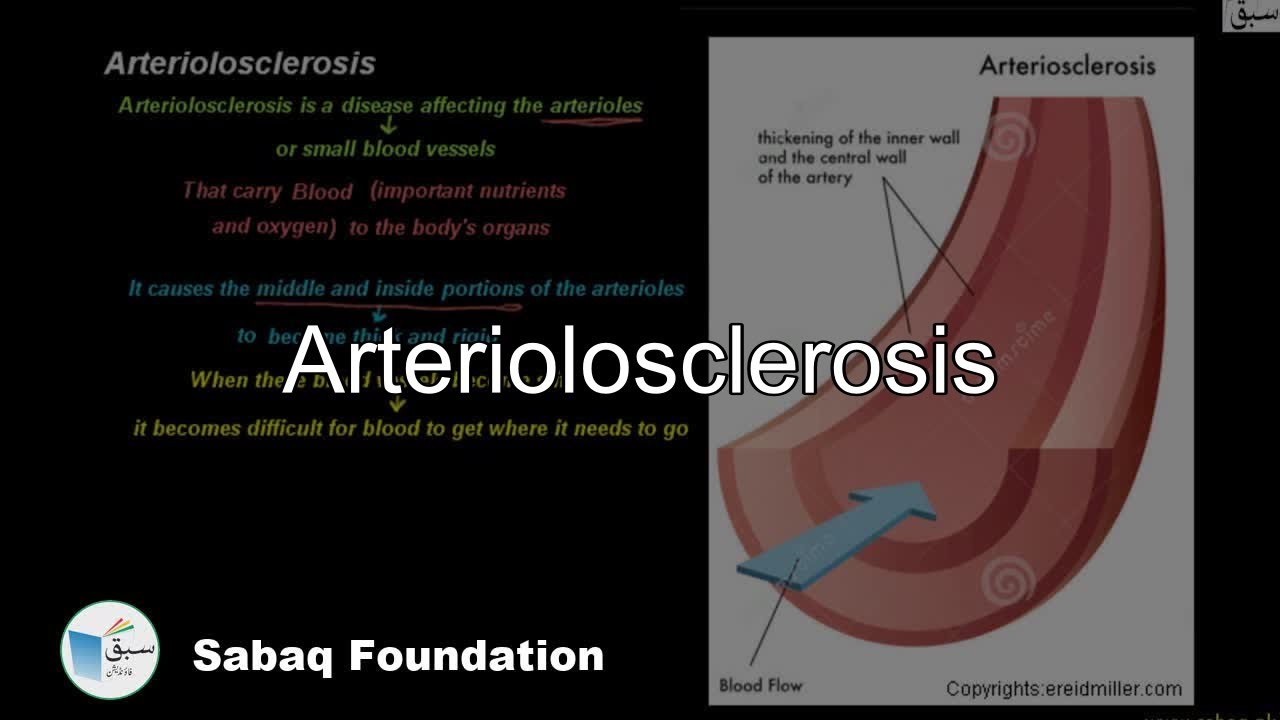 Arteriolosclerosis, Biology Lecture | Sabaq.pk - YouTube