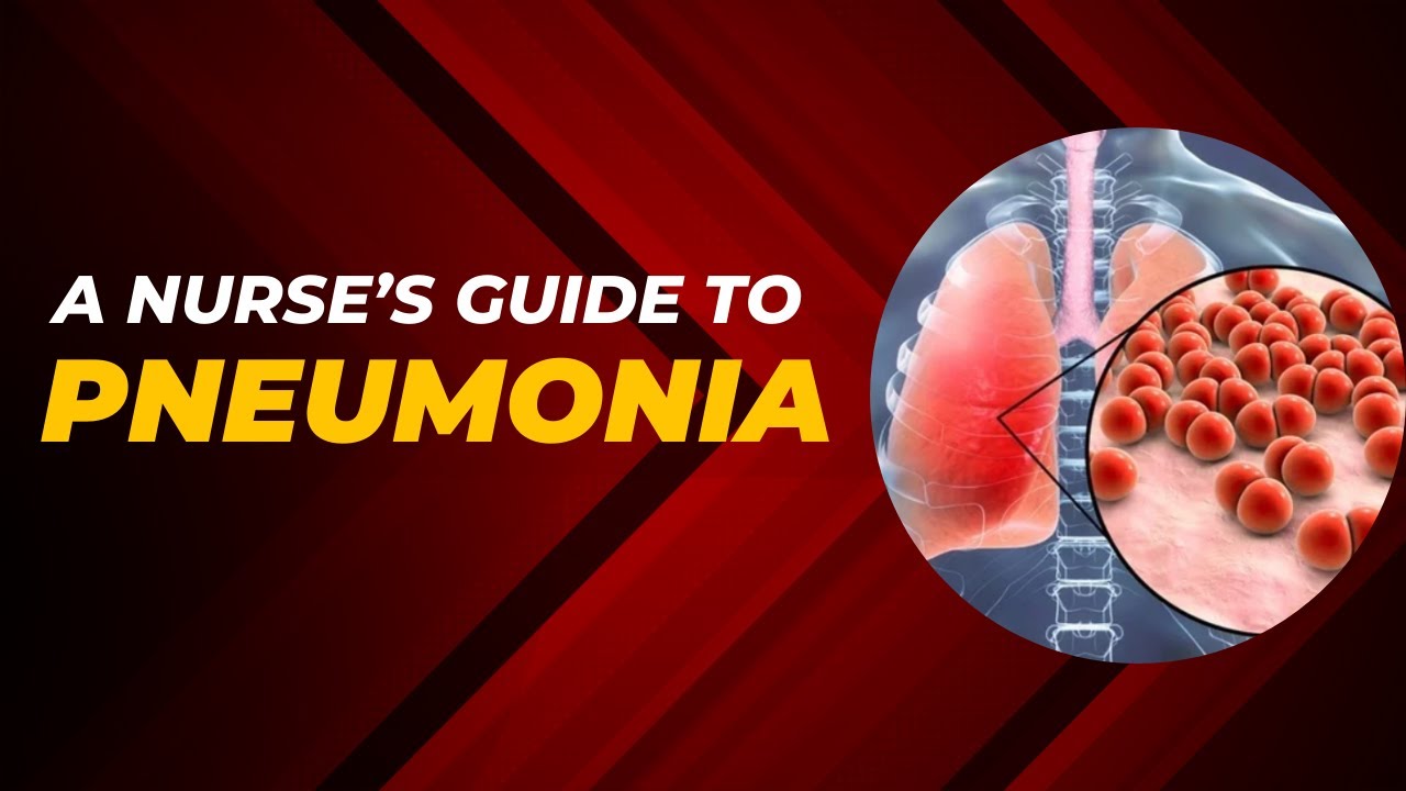 Pneumonia: Definition, Classification, Pathophysiology, Diagnosis, and ...