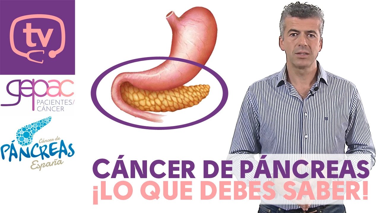 Cáncer de páncreas ¡todo lo que debes saber! - YouTube