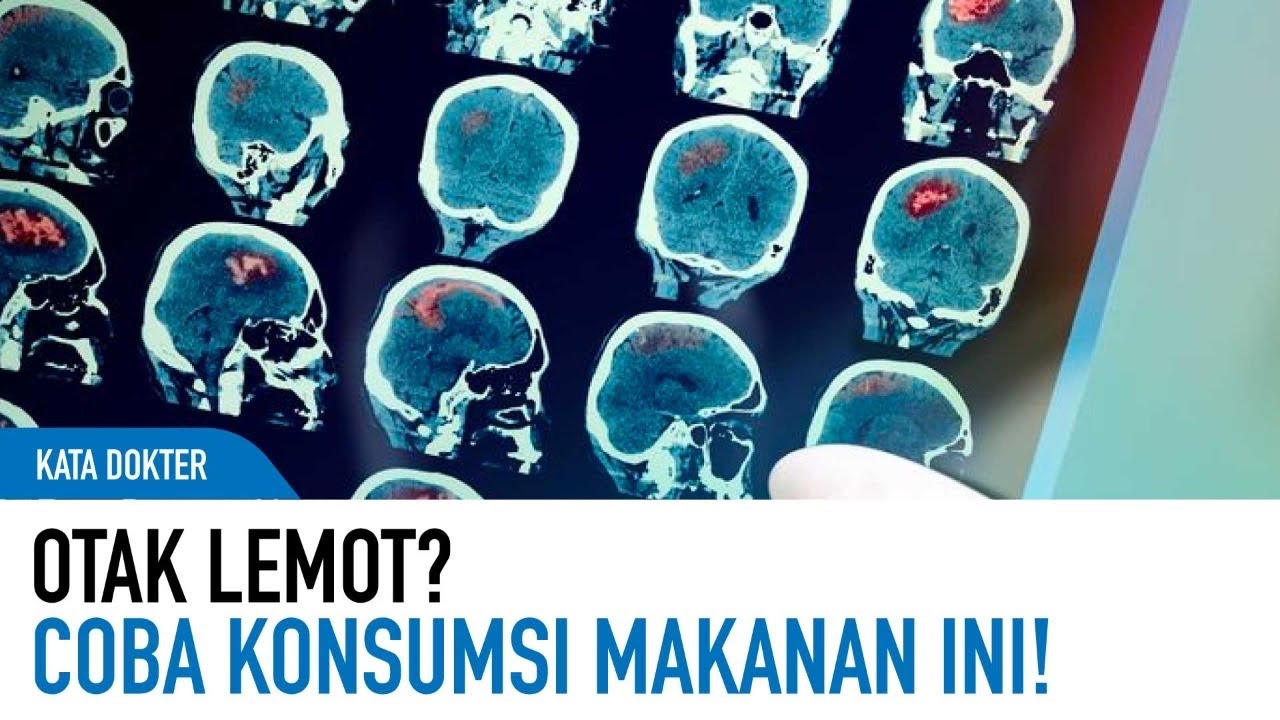 Otak Lemot? Ini Daftar Makanan Yang Tingkatkan Performa Otak | Kata ...