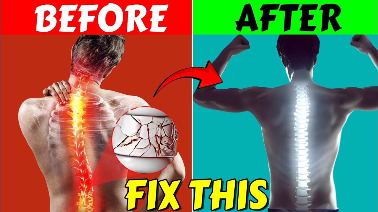 The Silent Disease: A Deep Dive into Osteoporosis - YouTube