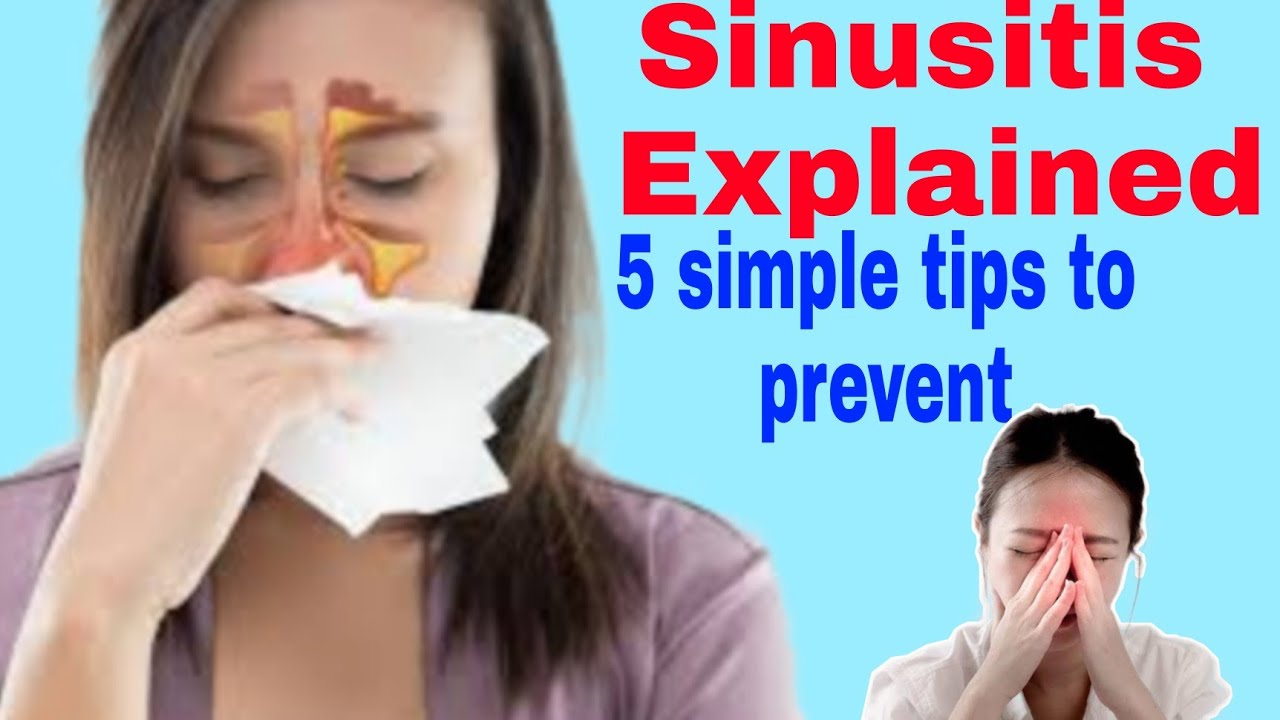 Sinusitis Explained |How to prevent sinusitis pressure |Dr. Nawaz - YouTube