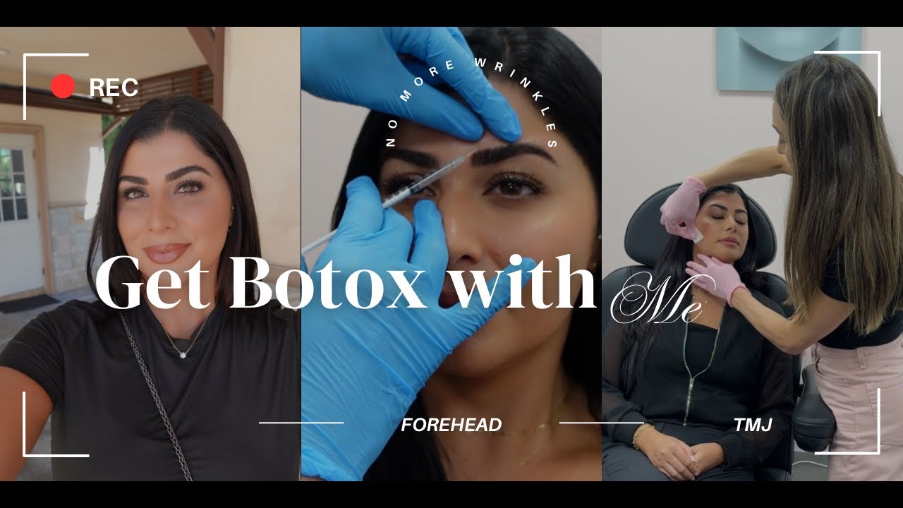 Getting preventative forehead Botox at 29 & first time doing TMJ Jaw ...
