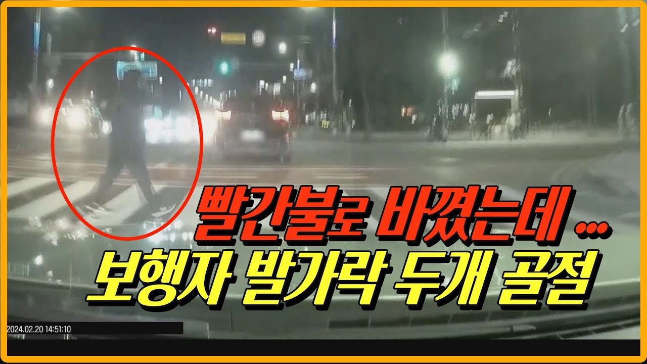 21336회 신호대기 중 차량 신호로 바뀌어 앞차를 따라 출발하는 순간 왼쪽에서 횡단보도를 건너는 보행자를 충격~~ 발가락 두
