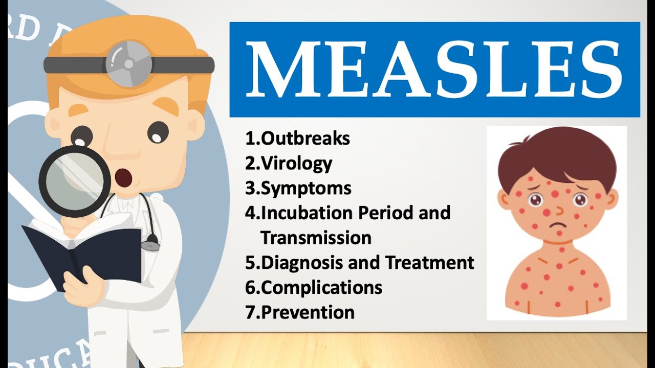 Measles Basics - Symptoms, Transmission, Incubation, Diagnosis, Treat ...