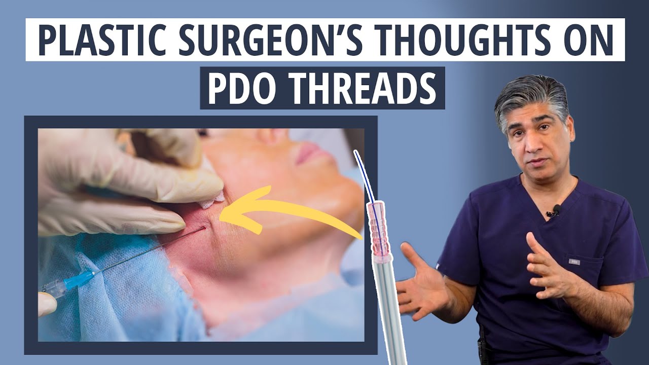 Watch this before you get PDO Threads | Facial Plastic Surgeon - YouTube