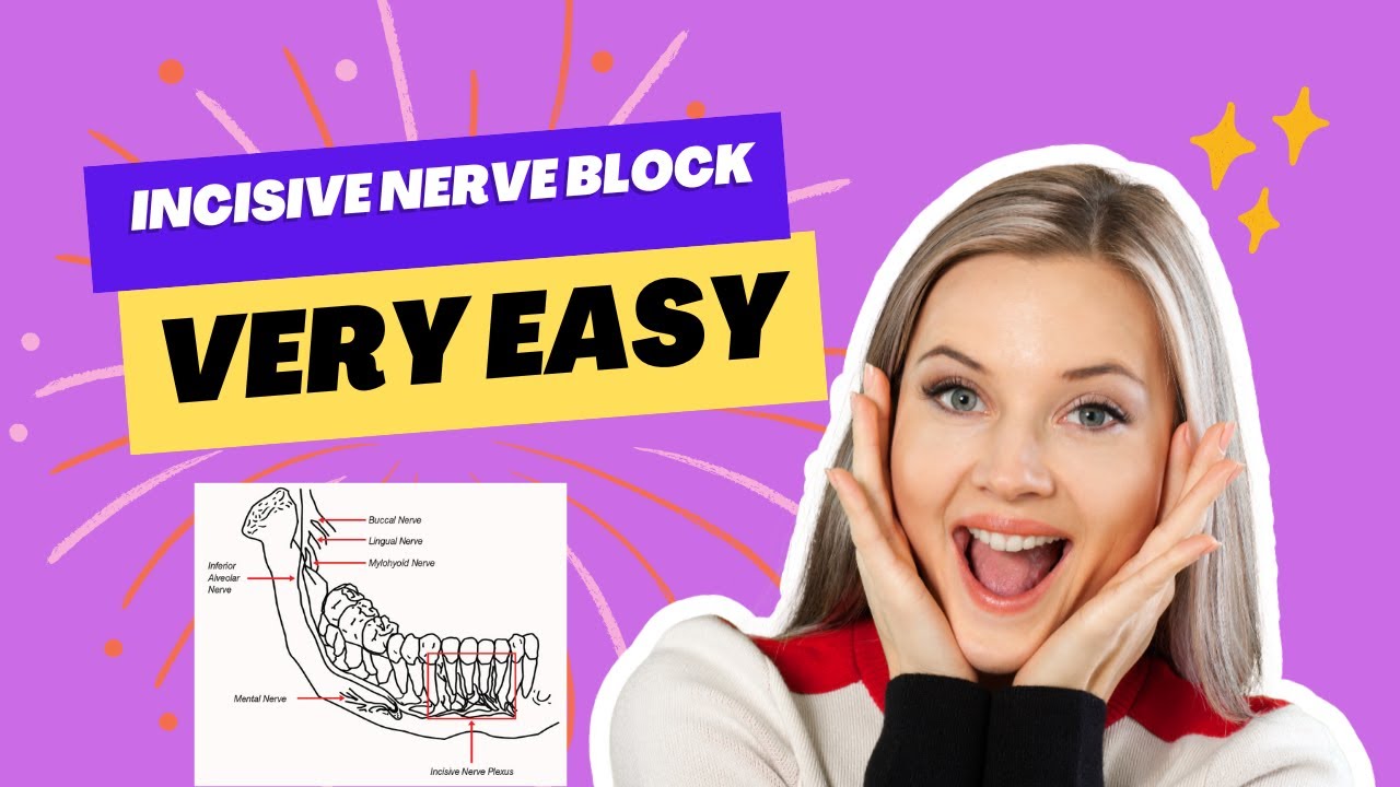 INCISIVE NERVE BLOCK PROCEDURE - Everything you need to know - YouTube