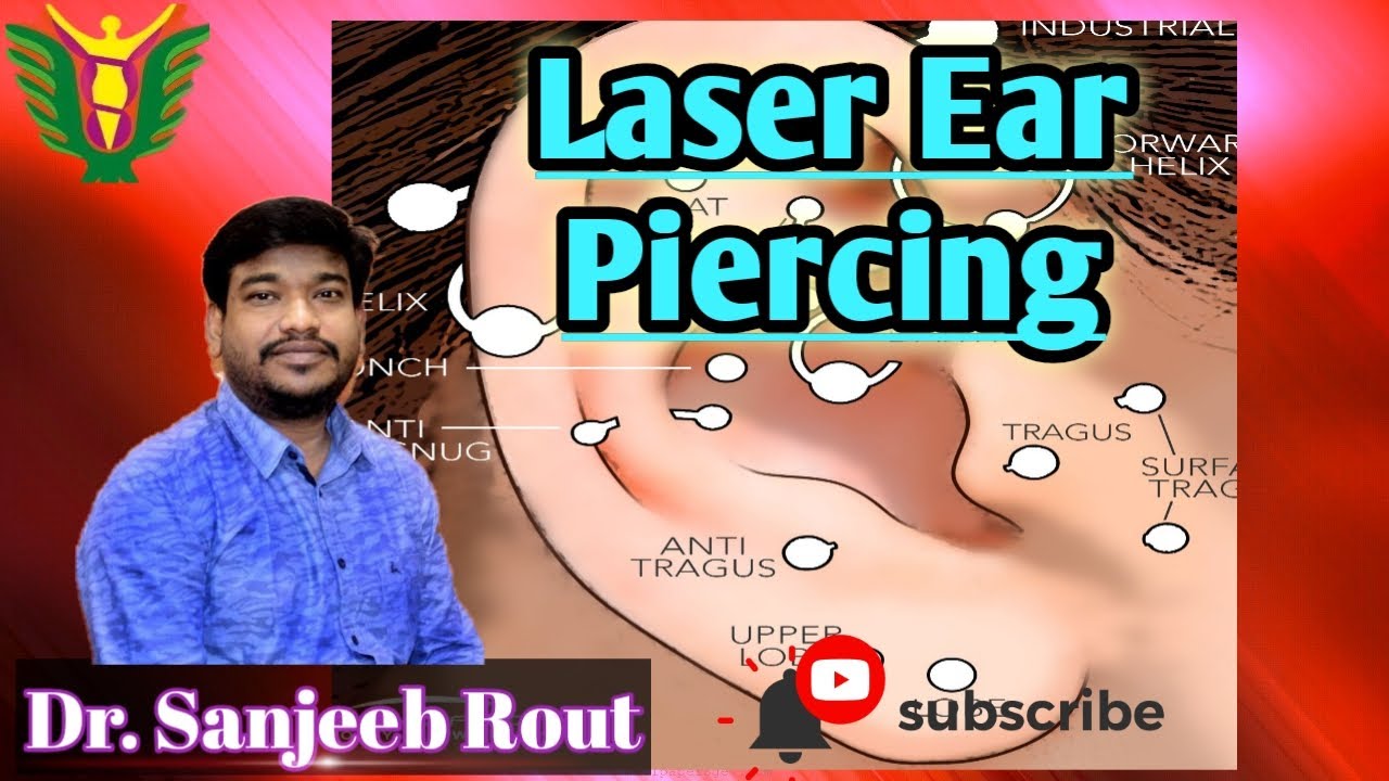 Laser Ear Piercing | Dr. Sanjeeb Rout | Balaji Skin and Hair Clinic ...