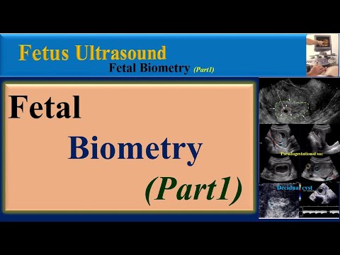 Fetus Ultrasound, Fetal Biometry(Part1) - YouTube
