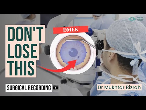 Never Lose Your Ink Mark in DMEK Surgery Again - YouTube