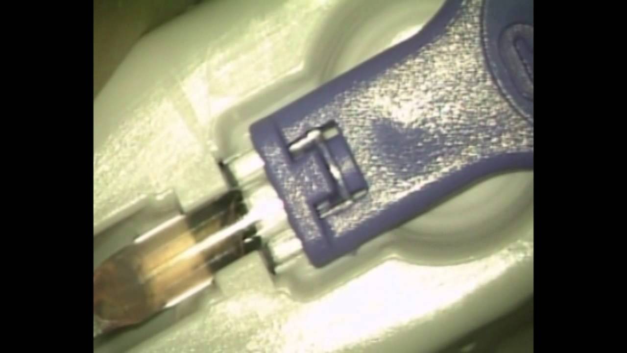 Tan EndoGlide insertion system - Live surgery & animation - YouTube