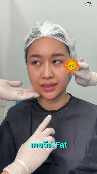 สาวมีแก้มต้องดู แก้มแบบไหนเหมาะกับการร้อยไหม ที่ V-Won Clinic - YouTube