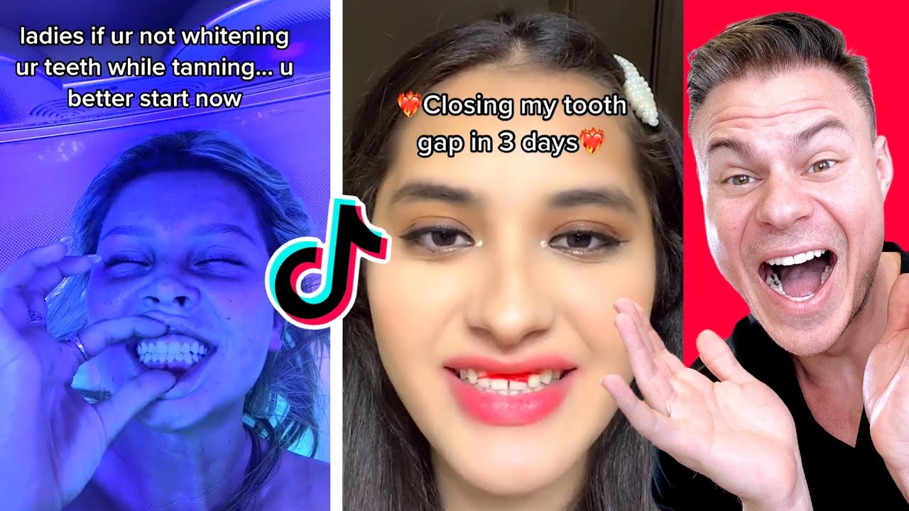 Orthodontist Reacts To The CRAZIEST Braces/Teeth Trends On Tiktok ...