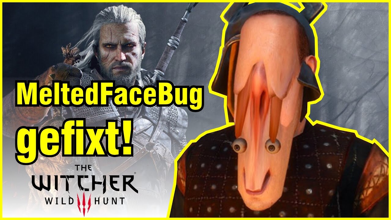Witcher 3 - Melted Face Bug Fix - YouTube