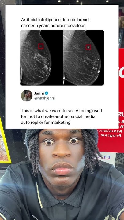 Artificial intelligence detects breast cancer 5 years before it ...