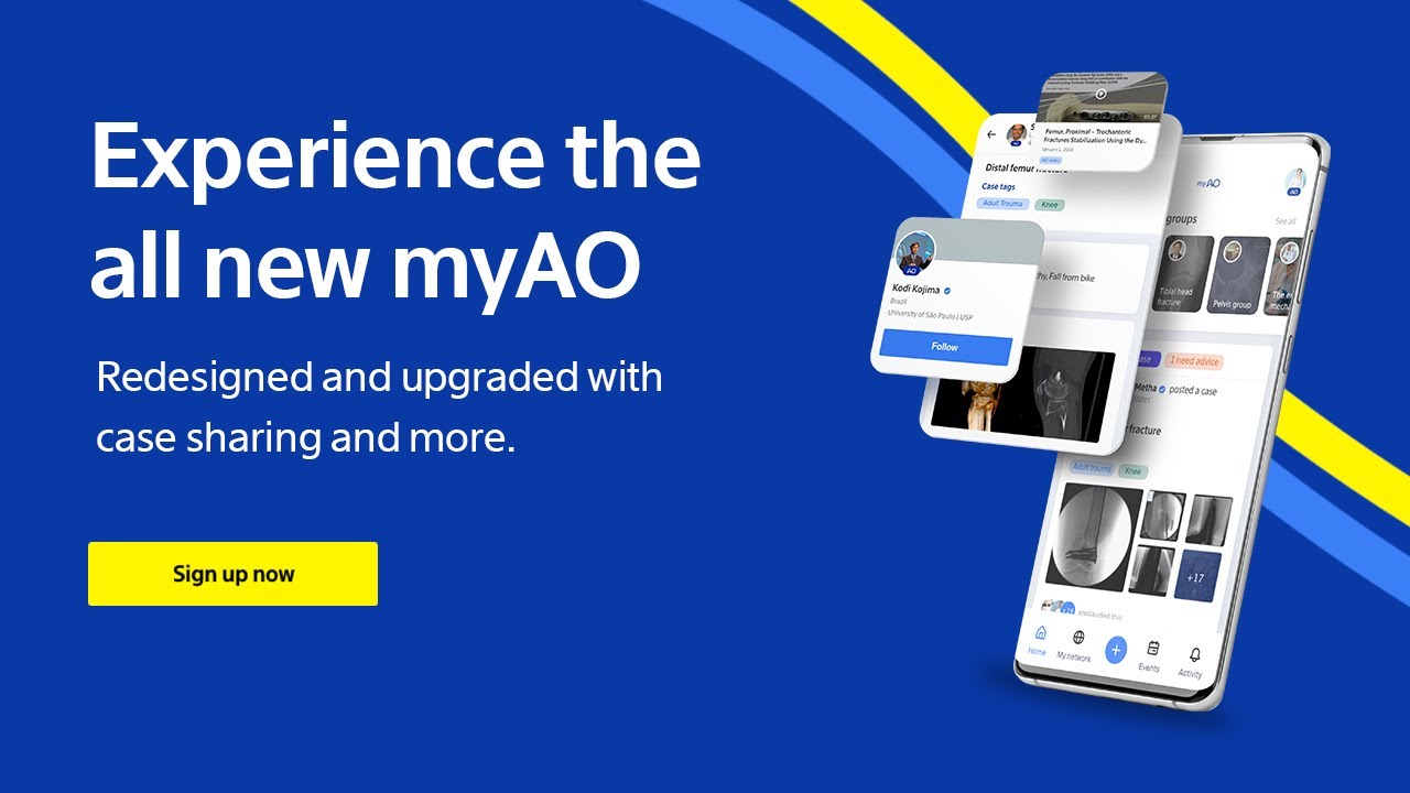 Say hello to the all-new myAO - YouTube