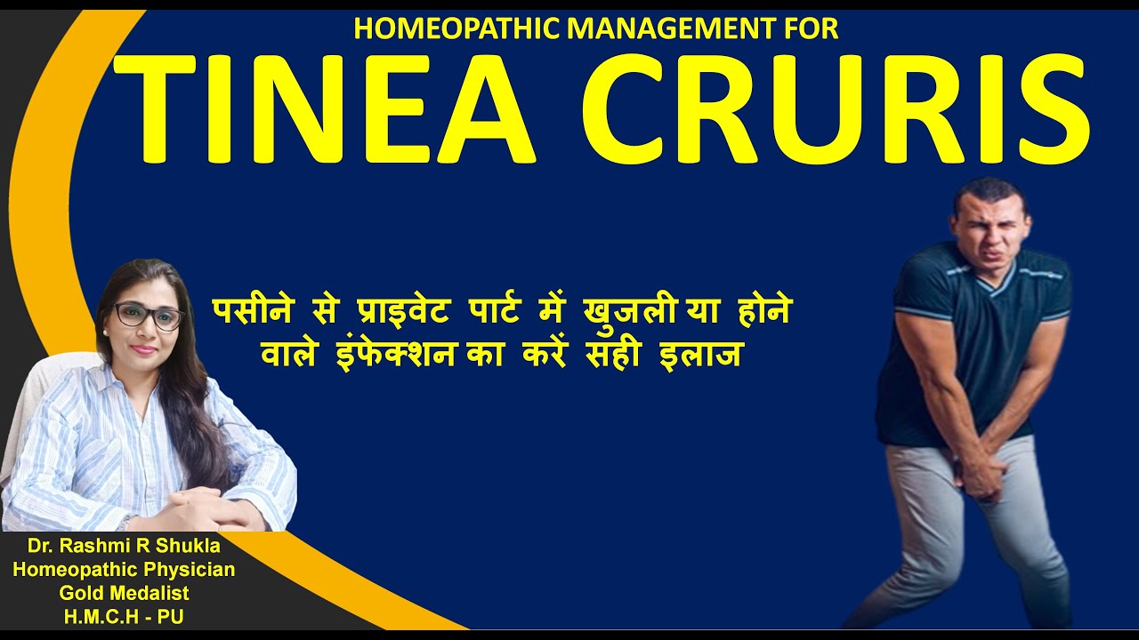 Tinea Cruris/ jock itch best homeopthic treatment| प्राइवेट पार्ट के ...