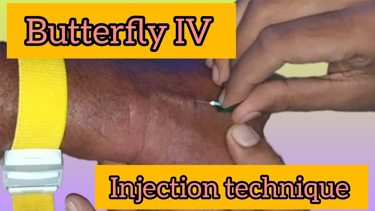 Butterfly IV Injection Technique । বাটারফ্লাই দিয়ে কিভাবে ইঞ্জেকশন ...