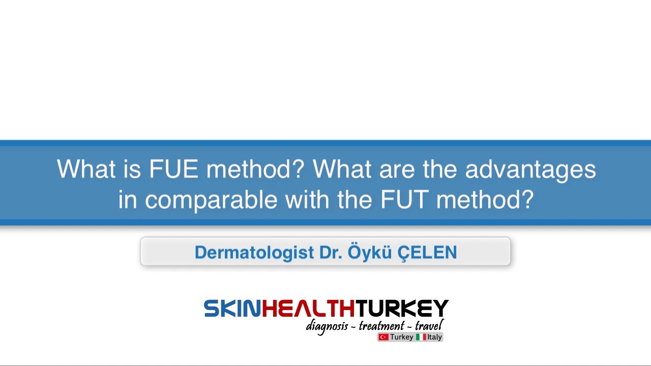 Hair Transplant - What is FUE method? What are the advantages in ...