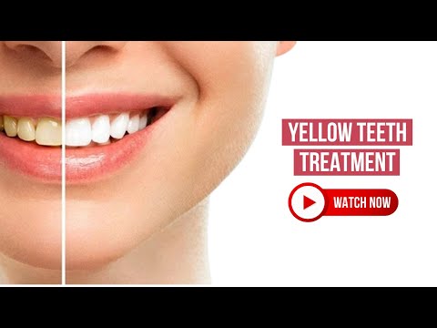How To Clean Yellow Teeth By Dentist