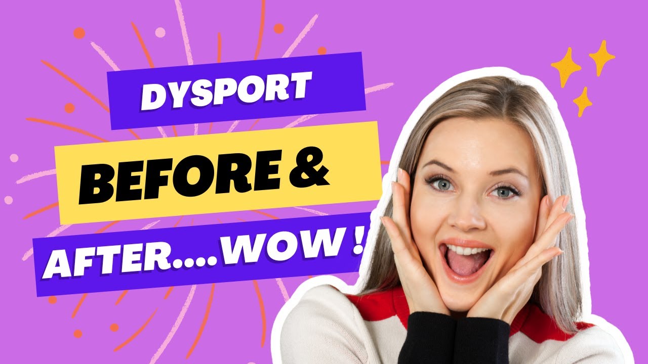 Dysport Before and After Long Island , Forehead, Crow's and Gummy Sile ...