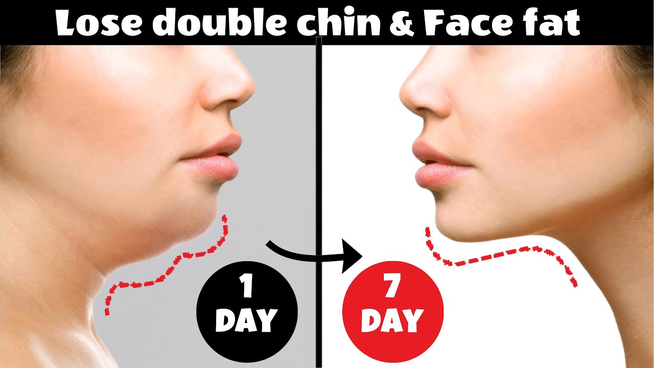 Lose Double Chin & Face Fat in 7 Days 🔥 Lose Neck Fat | Slim Face ...