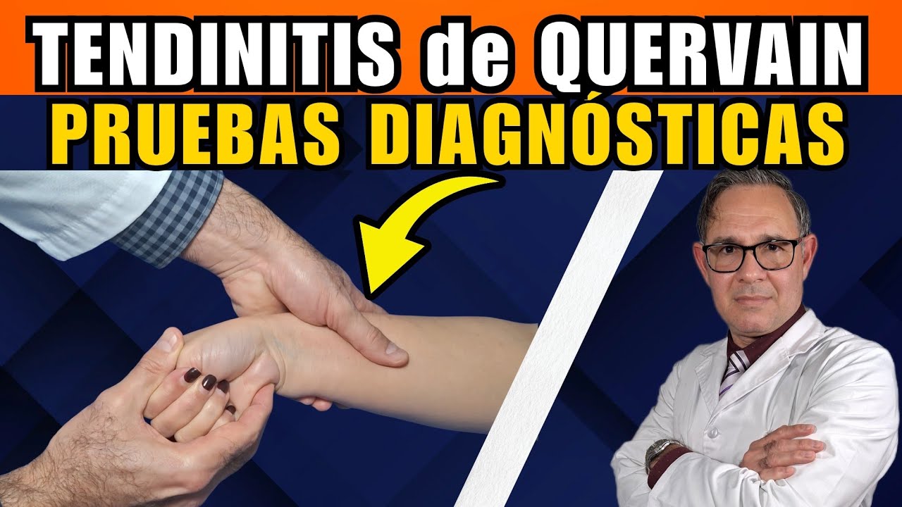 Pruebas diagnósticas para la Tendinitis de Quervain: Eichhoff vs ...