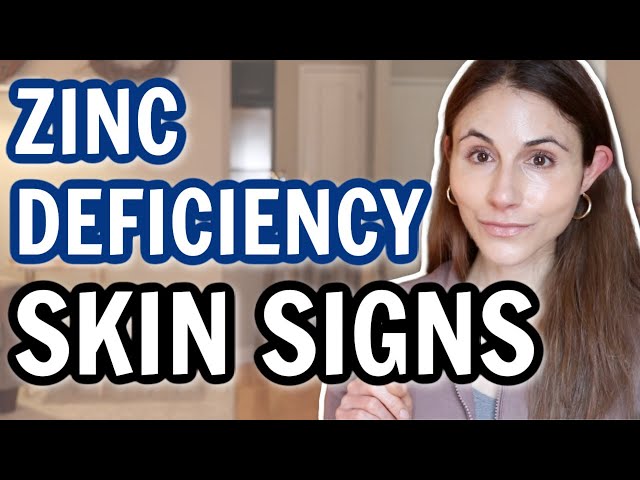 Zinc Deficiency Rash
