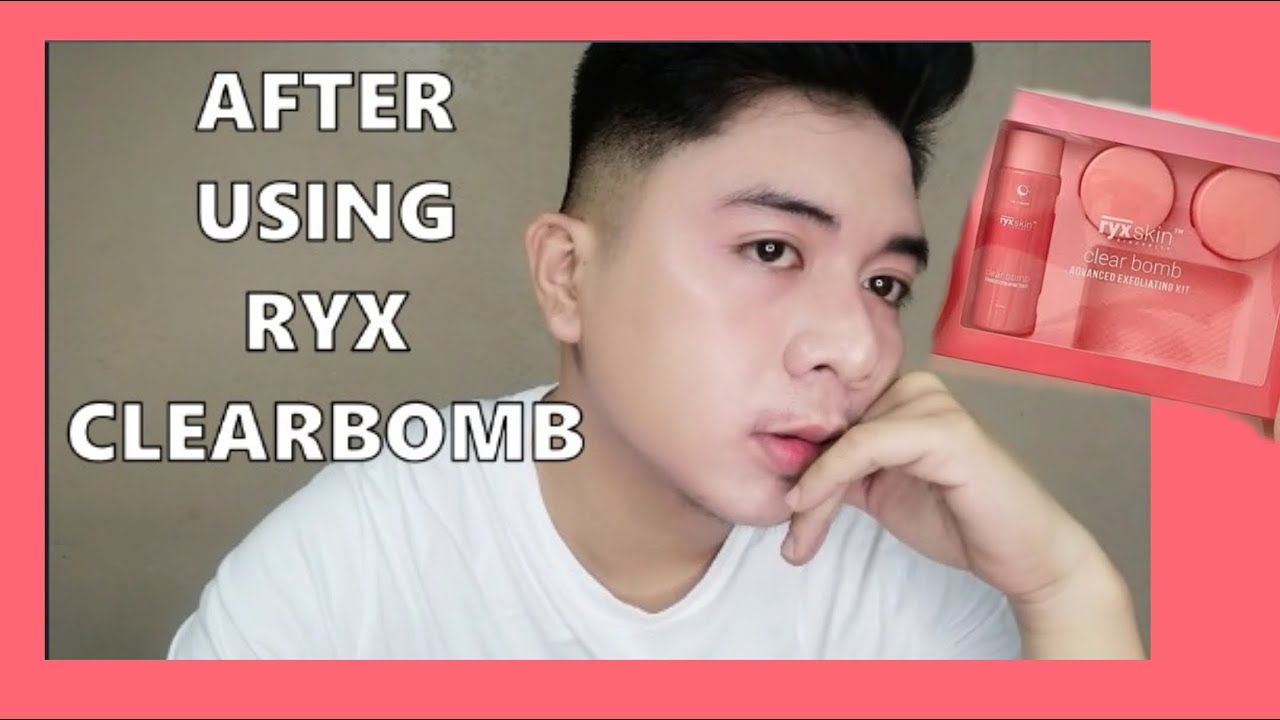 RYX SKINCERITY CLEAR BOMB REVIEW +15 DAYS UPDATE| RYX ADVANCE ...