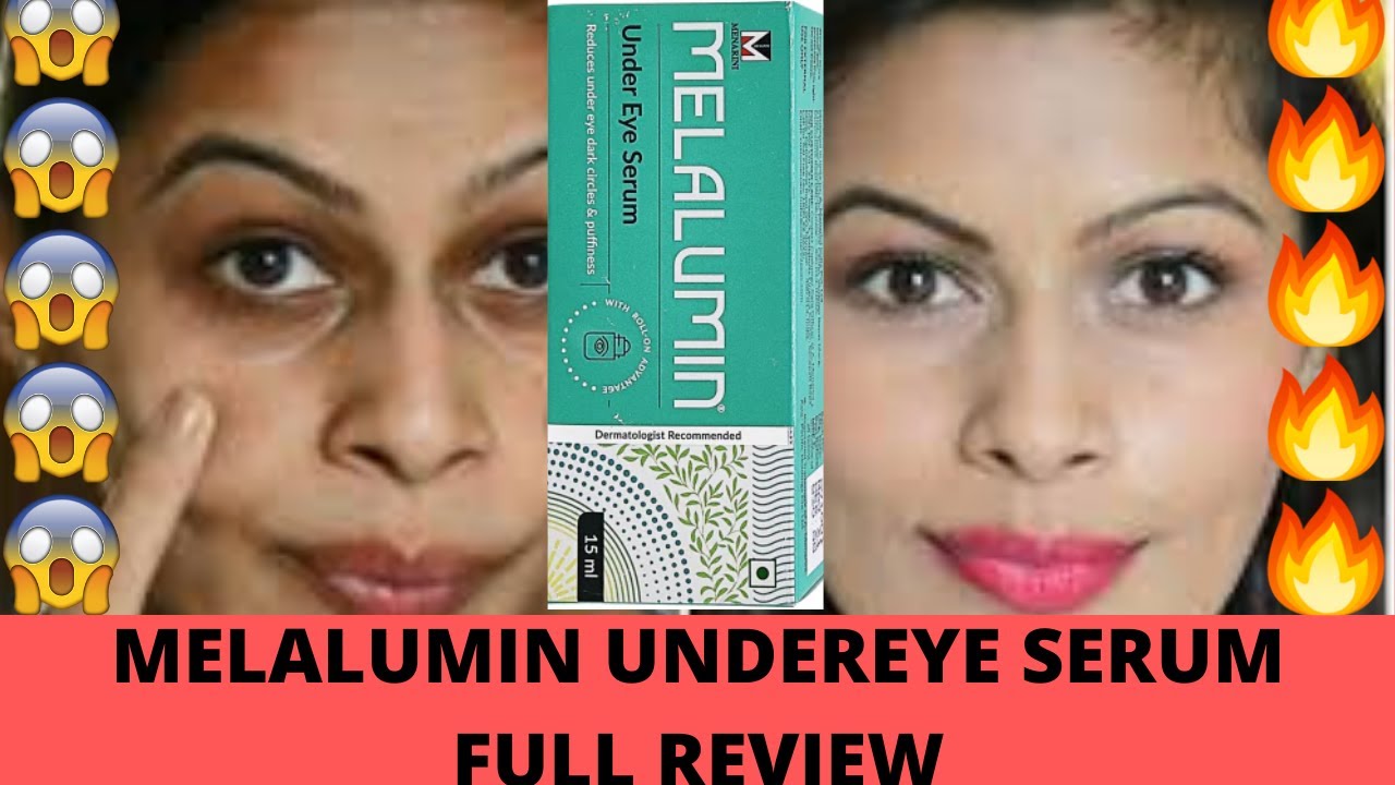 "Say Goodbye to Dark Circles with Melalumin Under Eye Serum! 👁️ # ...