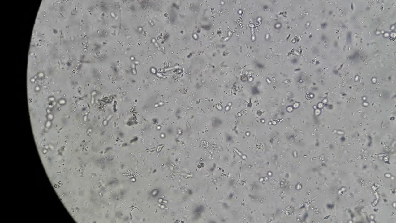 Levure dans le selles à l'examen direct - YouTube