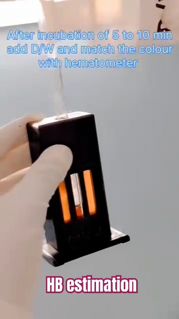 Hb estimation || sahlis method || practical hb estimation || - YouTube