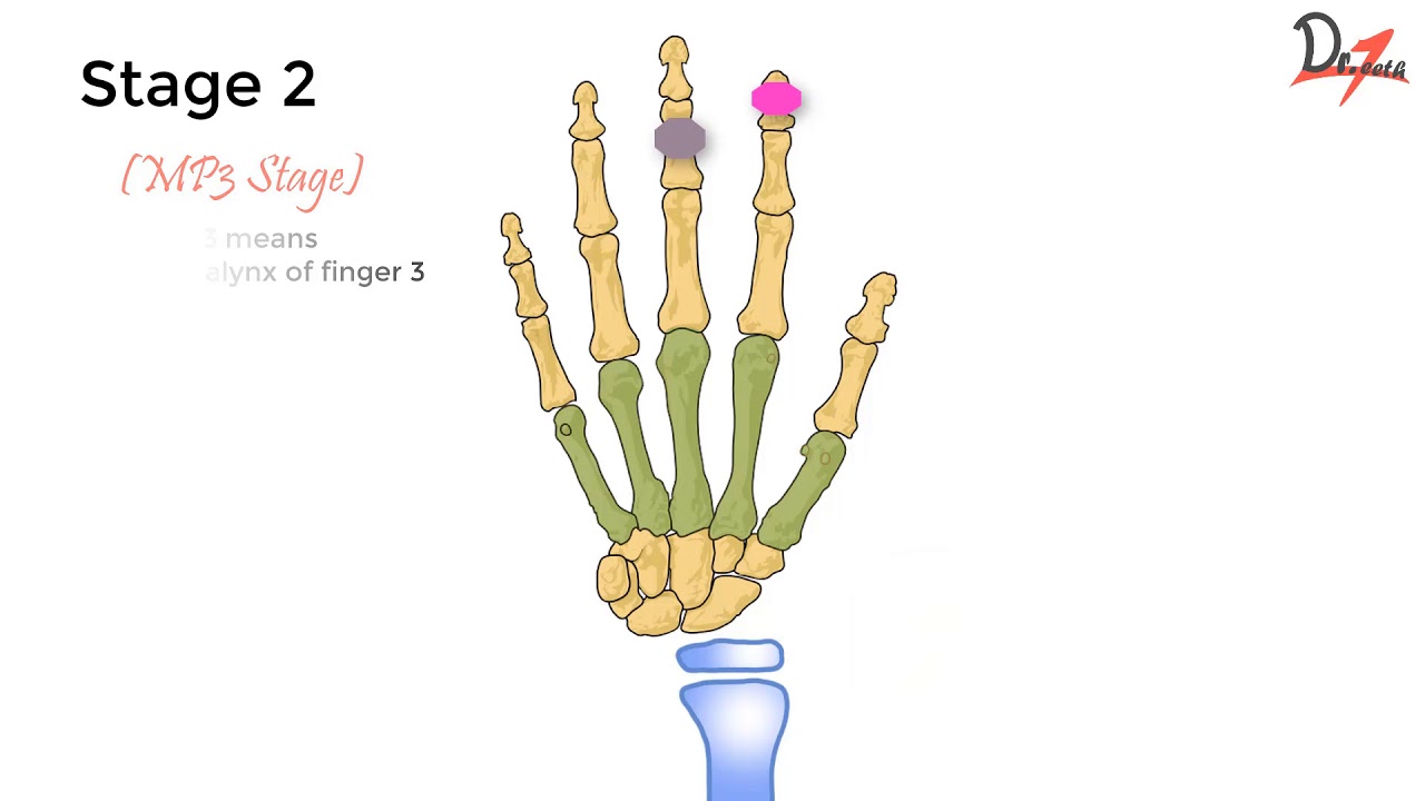 Bjork, Grave and Brown method | SMI | - YouTube