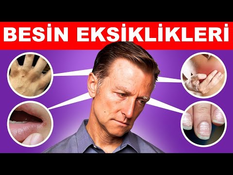 Depresyonun Arkasındaki 5 Besin Eksikliği | Dr. Berg Türkçe