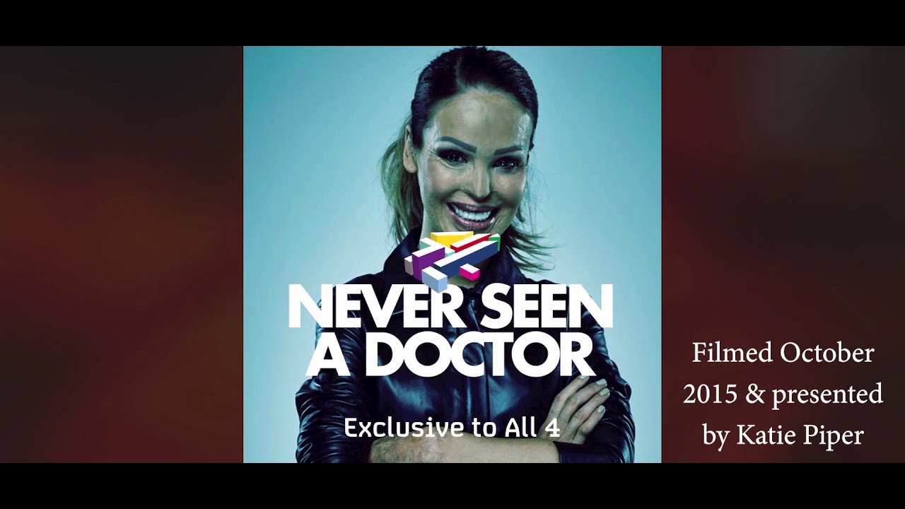 Scott Sadowski's hair transplant filmed for 'Never See A Doctor' in ...