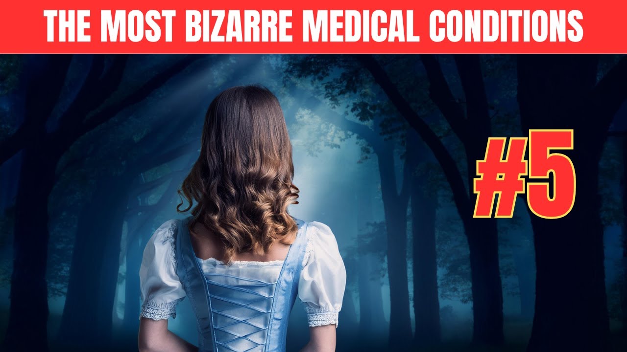 Top 10 World's MOST BIZARRE Medical Conditions | Number 5 - YouTube
