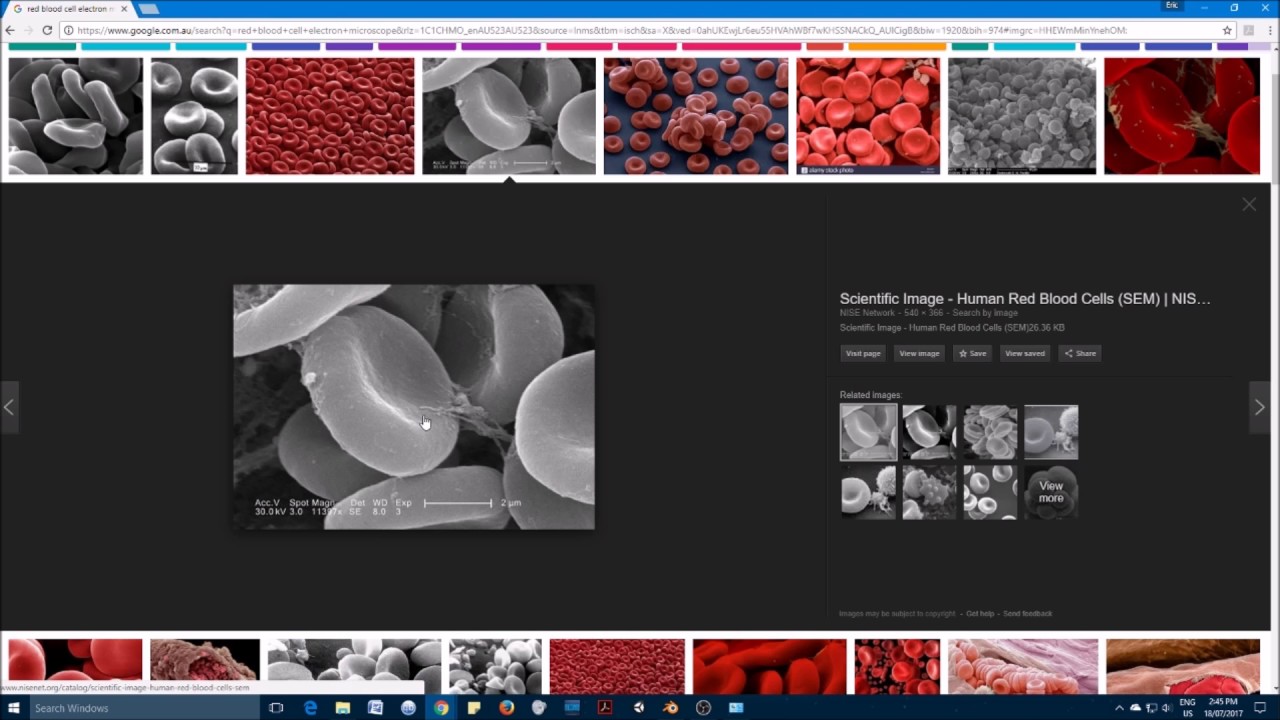 Making a Red Blood Cell (RBC) in Blender - Part 3: Biconcave Feature ...