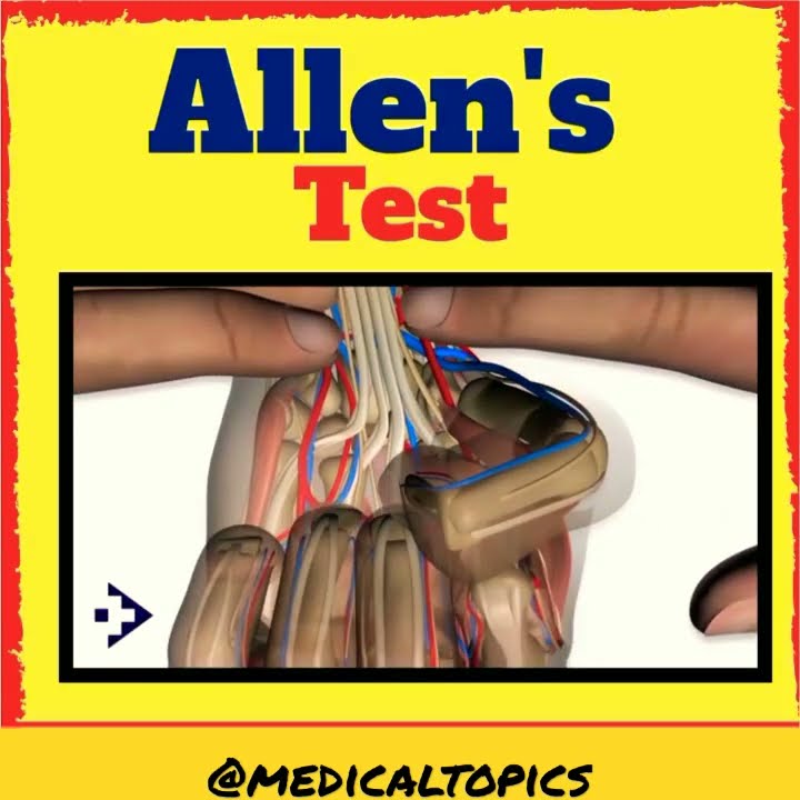 How to perform Allen's Test? Allen's Test #Allenstest #test - YouTube