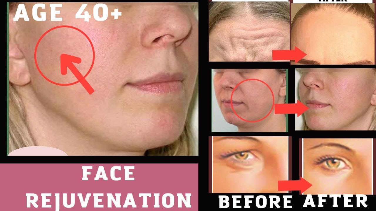 Age 40 +| Face Rejuvenation| Lift Sagging Skin |Smile Lines| Forehead ...