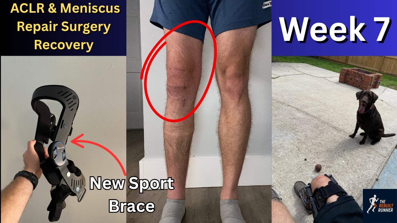 Walking, Driving, and ... NEW PT? - ACL & Meniscus Surgery | Week 7 ...