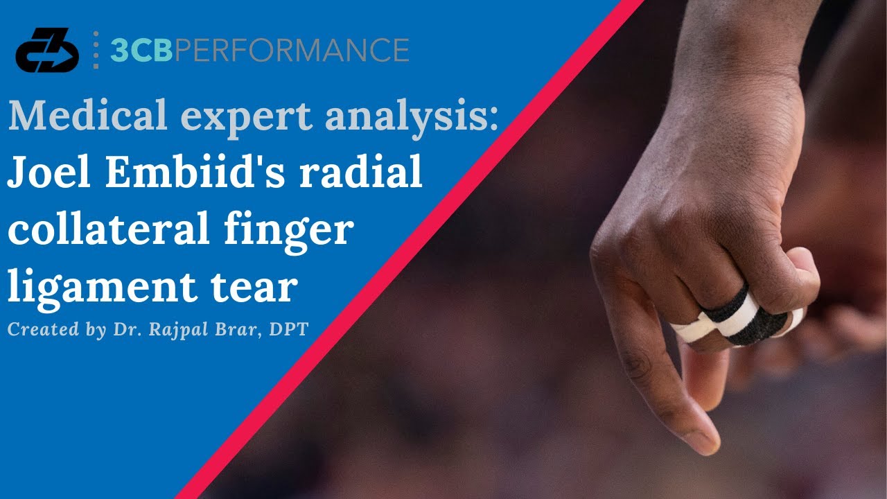 Joel Embiid's left 4th metacarpal ligament tear and 2 hand surgeon's ...