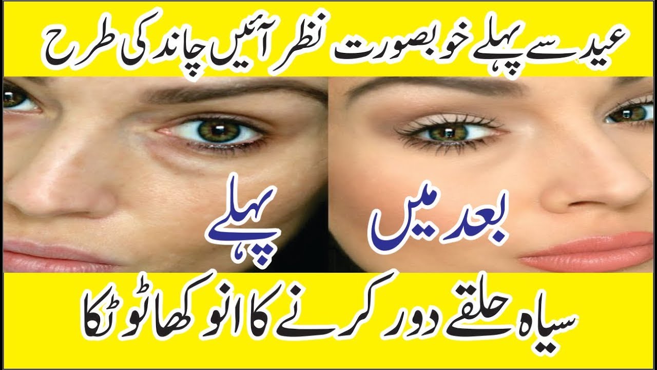 Dark Circles Under Eyes Home Remedy In Urdu Beauty Tips In Urdu Eid dark-circles-under-eyes-home-remedy-in-urdu-beauty-tips-in-urdu-eid