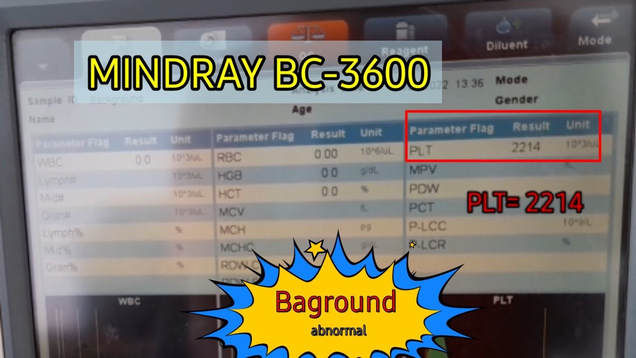 Baground abnormal hematologi mindray #mindraybc3600#mindrayhematologi# ...