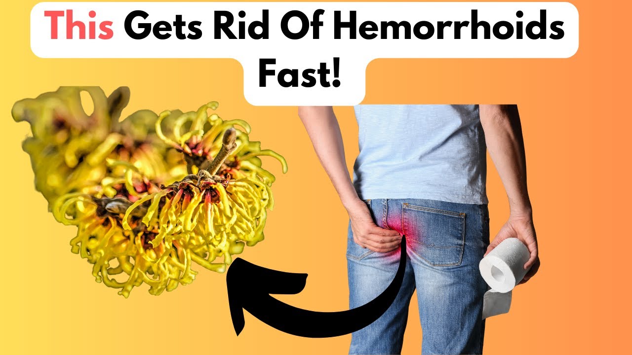 How to Get Rid of Hemorrhoids Fast: Effective Treatments You Need to ...