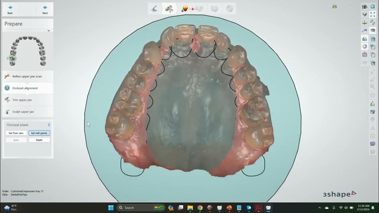 How to create a blockout model in 3shape - DentalTechTips - YouTube