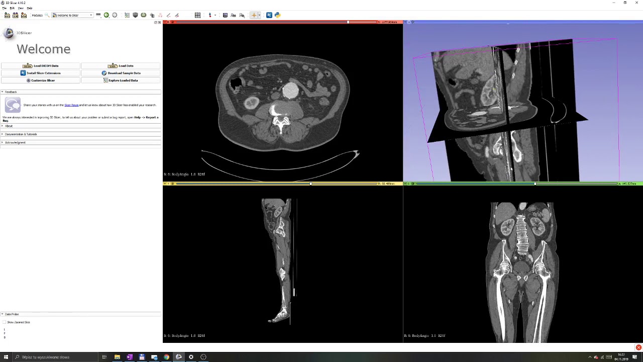 3D Slicer Tutorial #8: Navigation, Location and Cropping - YouTube