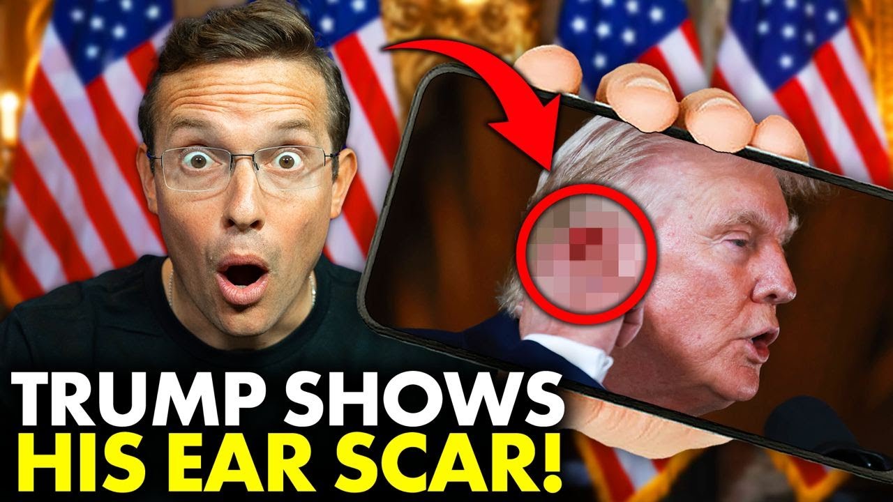 Reporters GASP As Trump Reveals EAR SCAR At WILD Press Conference: ‘I ...