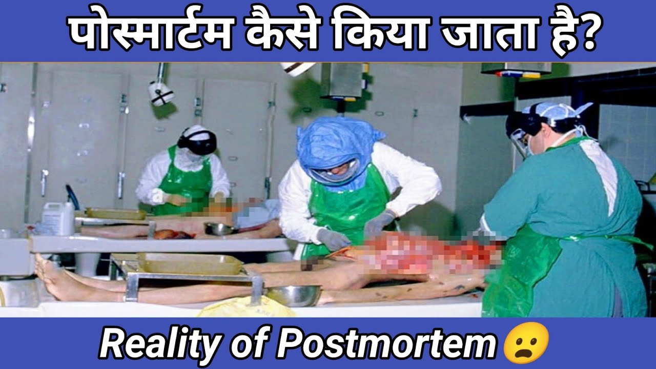 पोस्मार्टम कैसे किया जाता है? | Reality of Postmortem || Postmortem Kaise Hota Hai - YouTube